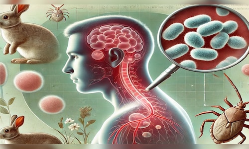 Rabbit Fever: इंसानों में तेजी से फैल रहा है रैबिट फीवर, डरा रही है ...