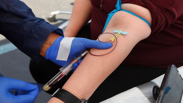 What is ‘Gwada Negative’, the rarest blood group discovered after 15 ...