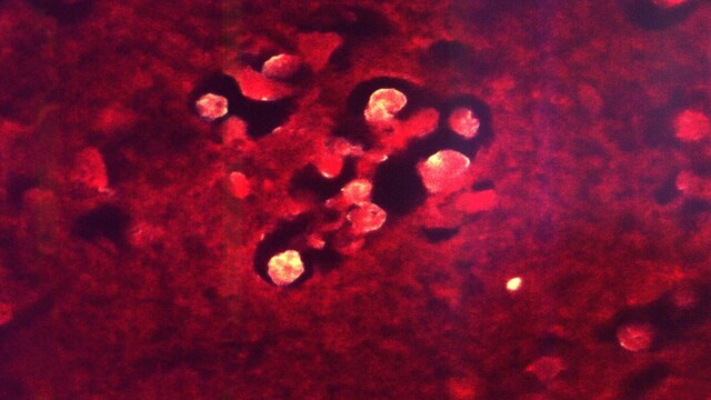 Brain-eating amoeba in US lakes and rivers claim 8 lives — How it ...