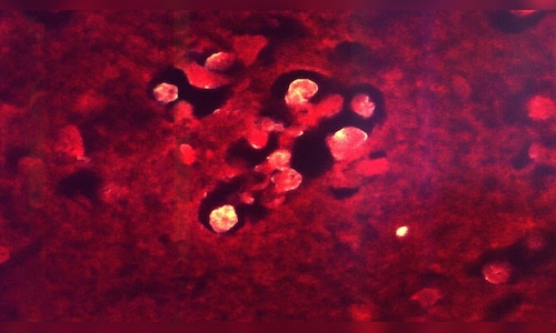 Brain-eating amoeba in US lakes and rivers claim 8 lives — How it ...