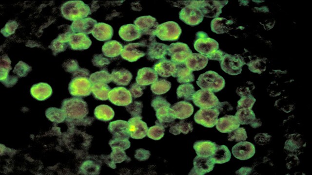 Three deaths in the last two months - What is the brain-eating amoeba ...