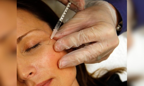 AbbVie makes $63 billion bid for Botox maker Allergan - CNBC TV18