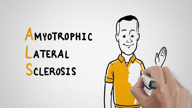 What is ALS disease, explained - CNBC TV18