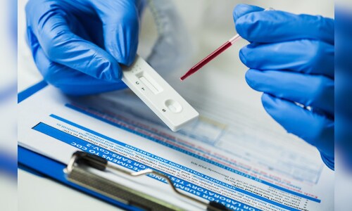 Non-invasive skin swab tests can quickly detect COVID-19: Lancet study ...