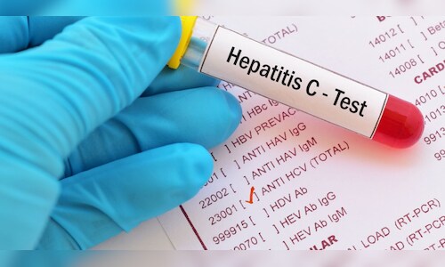 Explained: What is Hepatitis C? - CNBC TV18