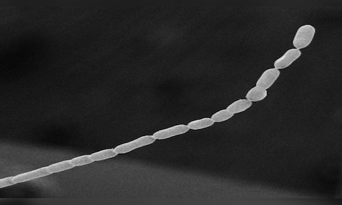 This bacterium grows up to the size of an eyelash and is visible to the ...