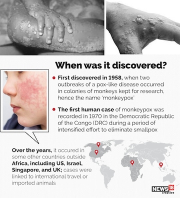 First monkeypox case found in Kerala — know all about the disease here ...