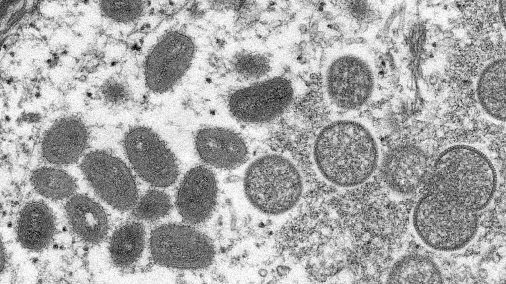 What Is Zombie Virus And Why Is Twitter Buzzing About It What Is Zombie Virus And Why Is Twitter Buzzing About It