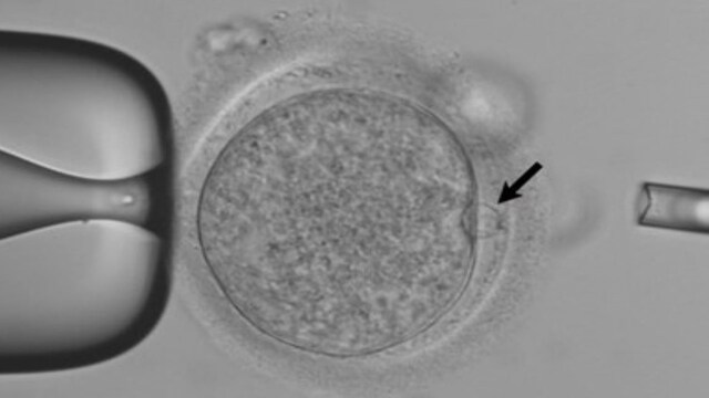 Cambridge University scientists develop synthetic human embryo using ...