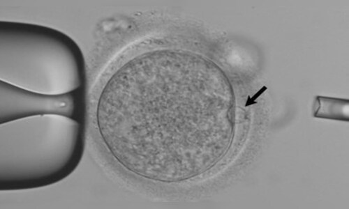 Cambridge University scientists develop synthetic human embryo using ...