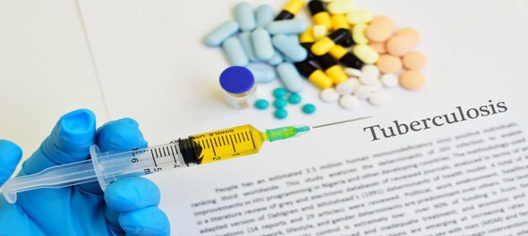 New-gen TB drug bedaquiline to become cheaper for Indian patients