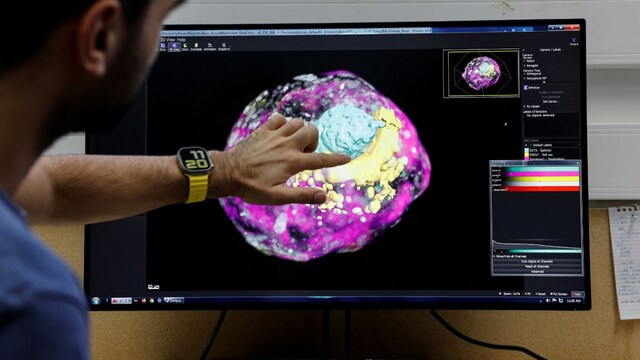 Israeli scientists create model of human embryo from stem cells without ... Israeli scientists create model of human embryo from stem cells without ...