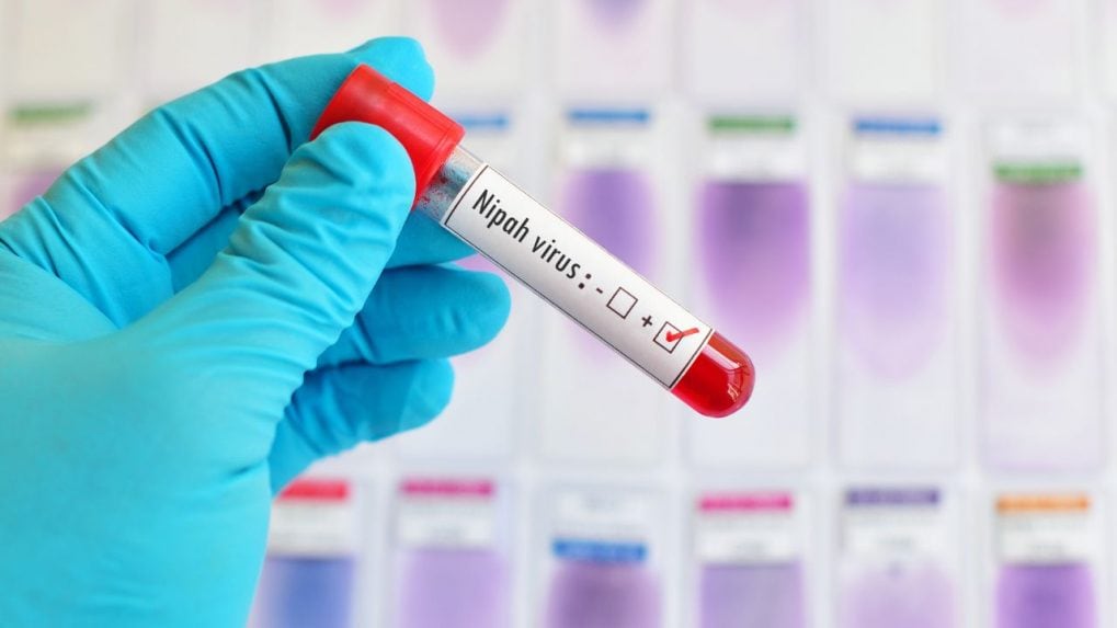 Nipah virus outbreak: 9 states at risk, situation under control in ...