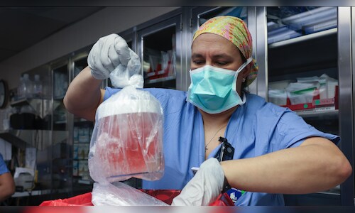 US surgeons achieve first-ever transplant of gene-edited pig kidney ...